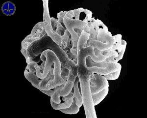 PLN - Protein Losing Nephropathy in Dogs & Cats